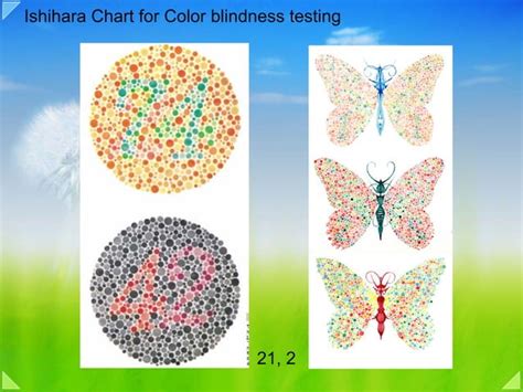 04c Visual Signal Processing Color Vision Ppt