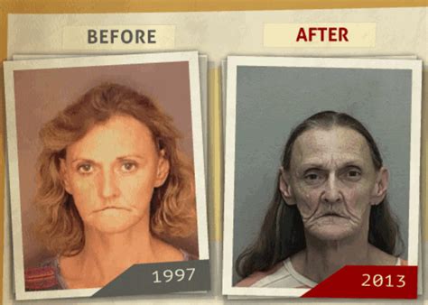 People Before And After Drugs