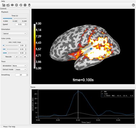 Enh New Interface For Brain · Issue 7162 · Mne Toolsmne Python · Github