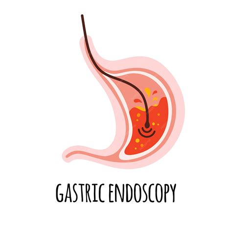 Premium Vector Endoscopy The Stomach Of A Person With Gastritis Gastroenterology Vector