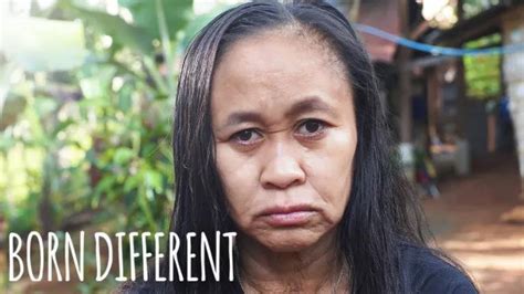 A 16 Year Old Filipino Girl Rapidly Aging Into The Face Of A 60 Year