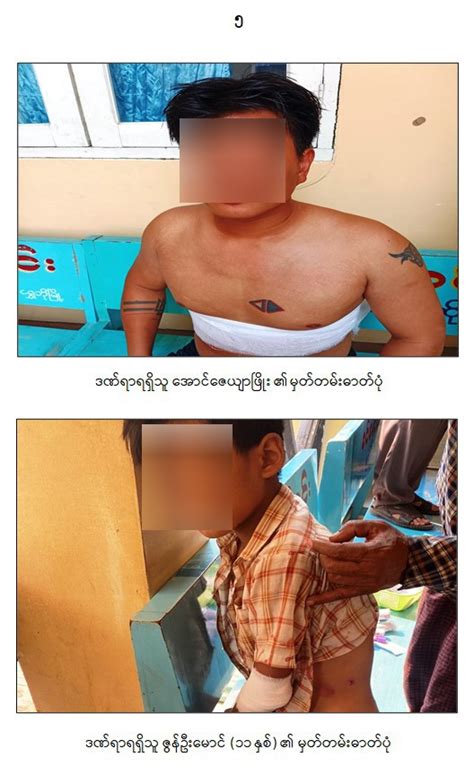 ရွှေဘိုမြို့ရှိ အဝေးပြေးကားကွင်းအနီး၌ Pdf အမည်ခံအကြမ်းဖက်သမားများ ထောင်ထားသည့် ဒေသန္တရလက်လုပ
