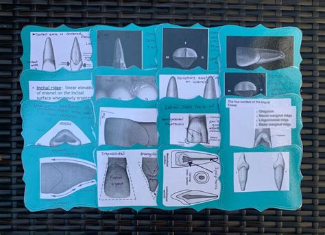 Dental Flashcards Incisor Tooth Morphology For Dental Hygiene Babes Etsy