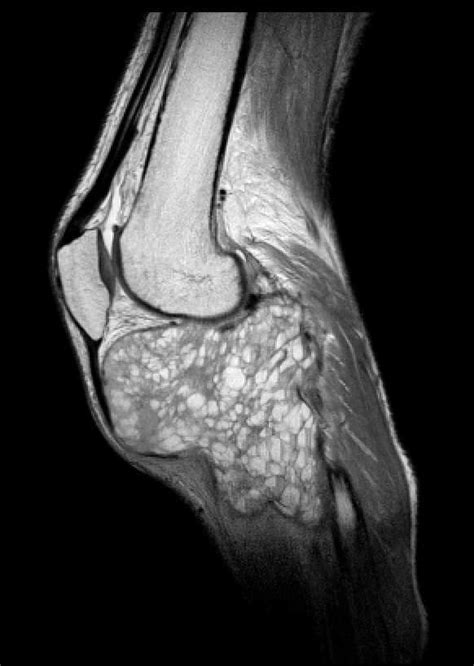 Hanzala Ahmed Posted On Linkedin