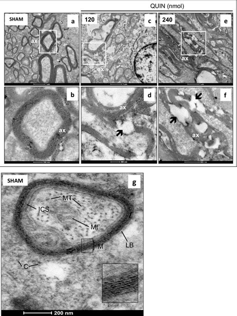 Axonal Morphological Alterations Induced By Quinolinic Acid Quin In Download Scientific