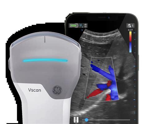 Portable Handheld Msk Ultrasound Vscan Air™ Ge Healthcare