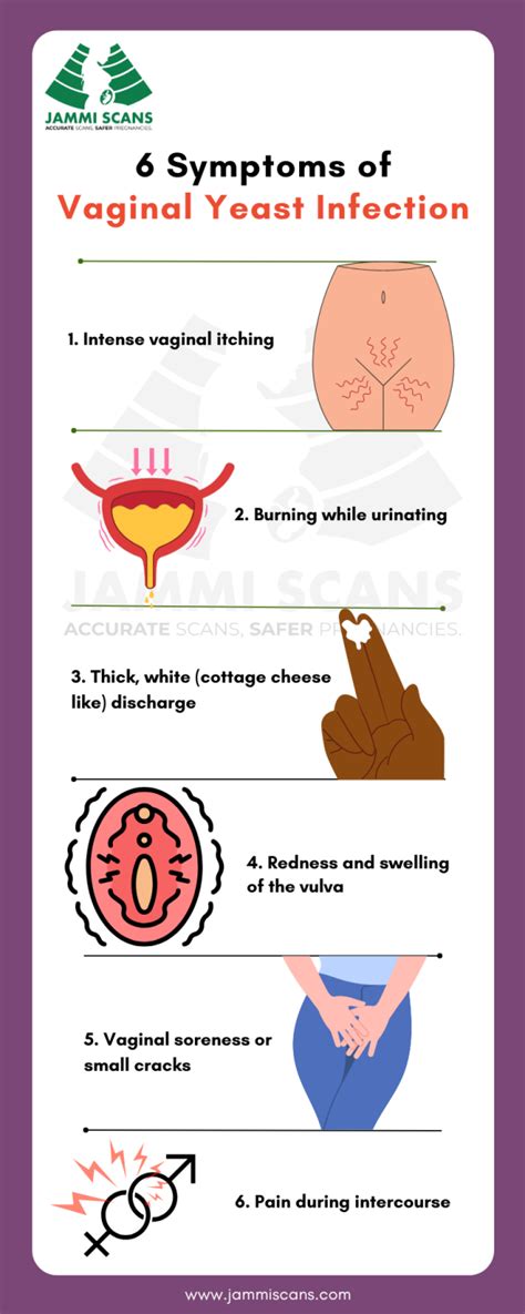 Vaginal Yeast Infection Symptoms Treatment And Prevention