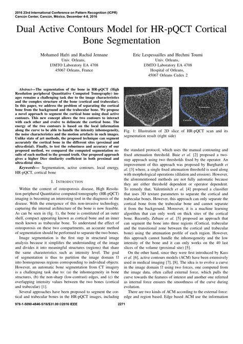 Pdf Dual Active Contours Model For Hr Pqct Cortical Bone Segmentation