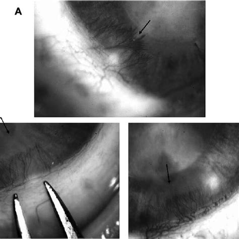 Photographs Of Corneal Nv At 7 Days After Lhp Injection A Control Download Scientific Diagram