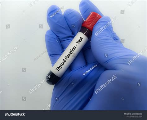 Tumor Marker Test Function Résultats 22 Dimages Libres De Droits