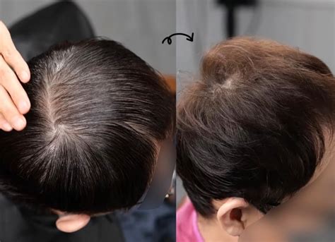 남자 여자 뿌리 볼륨펌 And 뿌리펌 효과와 유지 기간 가격 시간 총정리zip 네이버 블로그