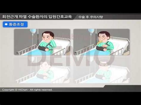 시연용 d0115aako 회전근개 파열 수술환자의 입원간호교육 YouTube