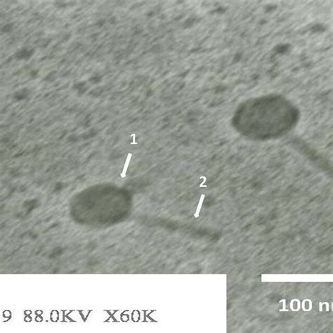 Pattern Of Lb1 Bacteriophage Plaque On Salmonella Download Scientific Diagram