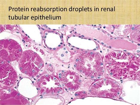Intracellular Accumulations Ppt By Dr Usman Nasir