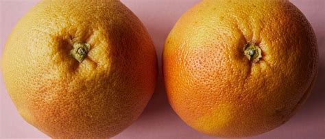 Kenapa Puting Payudara Ada Bintik Putih Liam Slater