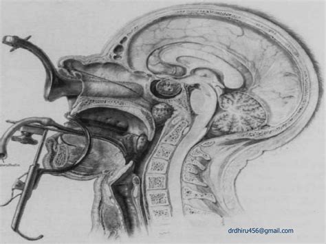 Transsphenoidal Hypophysectomy By Drdhiru456 Transsphenoidal Hypophysectomy By Drdhiru456