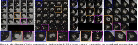 Figure 6 From A Progressively Trained Scale Invariant And Boundary