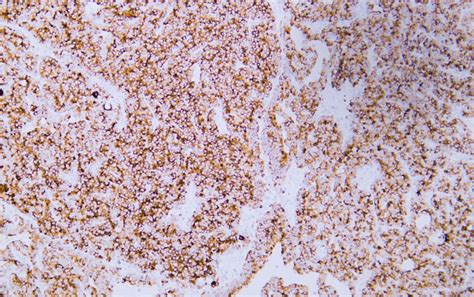 Parathyroid Hormone Pth Abt Pth Mouse Mab Ready To Use 产品 Immunoway 中文官网