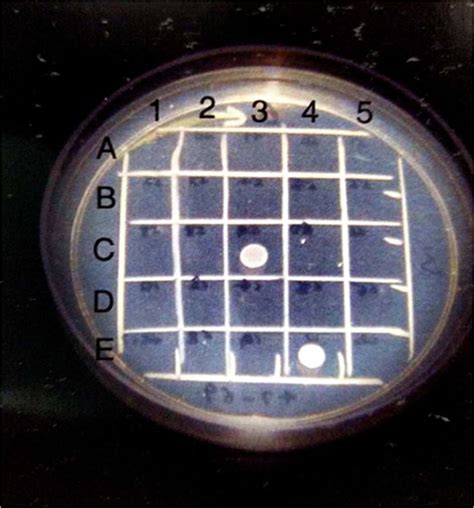 Oxacillin Resistance Screening Agar Base With Six μg Ml Of Oxacillin