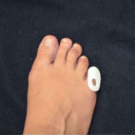Foot Supply Store Interdigital Corn Pad Toe Spacer One Eighth Inch Foam