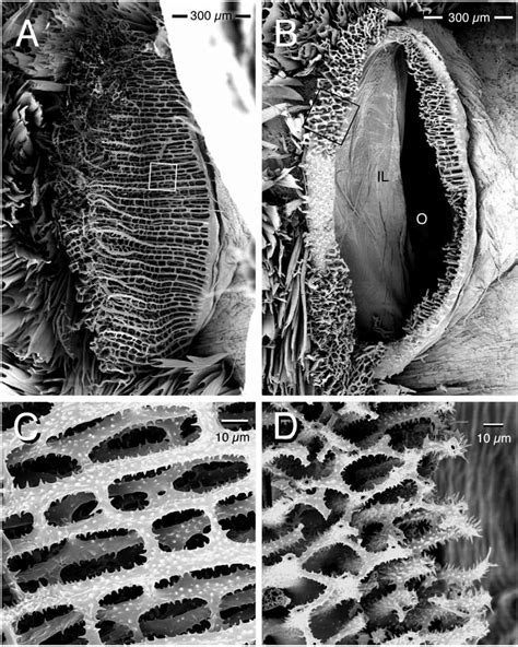 Scanning Electron Micrographs Of The Anterior Thoracic Spiracle After