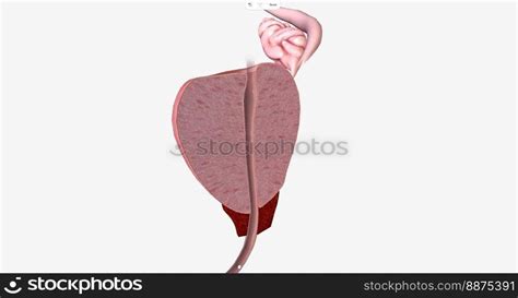 The Prostate Sagittal Cross Section 3d Rendering The Prostate Sagittal Cross Section