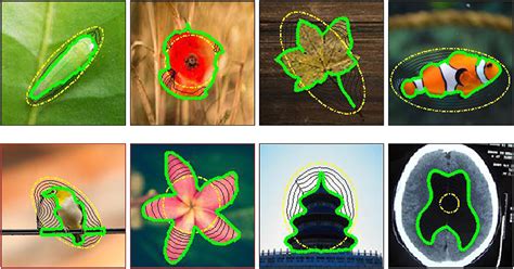 Frontiers Image Segmentation Using Active Contours With Image Structure Adaptive Gradient