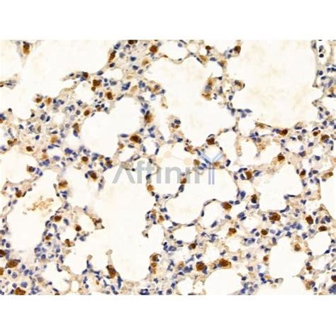 Hemoglobin Subunit Beta Antibody Affinity Biosciences Ltd亲科生物官网