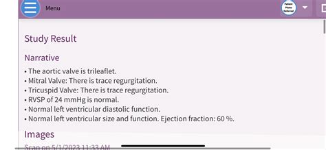 Echocardiogram Results R Askcardiology