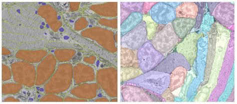 Segmentation Overview Bioimage Analysis Training Resources