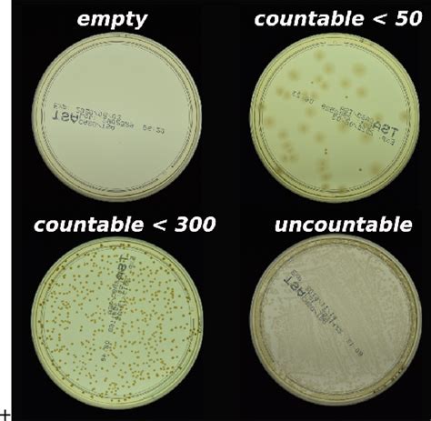 Figure 1 From Agar A Microbial Colony Dataset For Deep Learning Detection Semantic Scholar
