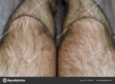 Very Hairy Male Legs Beauty Male Body Stock Photo Zagovoreny