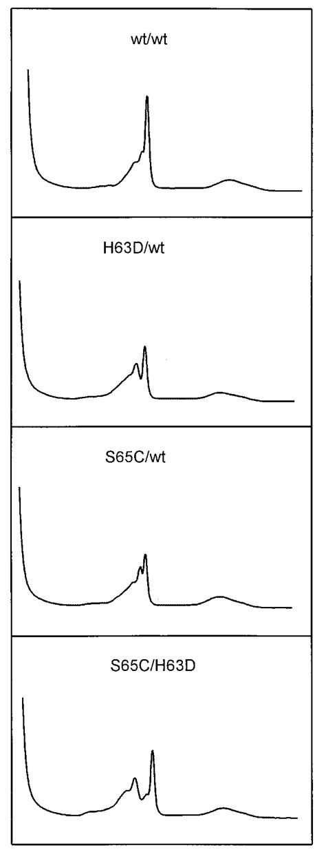 Dhplc Elution Profiles For H63d And S65c Mutations In Exon 2