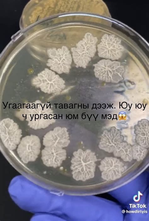 Саруул Эрдэнэ On Twitter Бидний хүүхдүүд шүдний өвчин хоолойн ангина ханиад хелико байнга