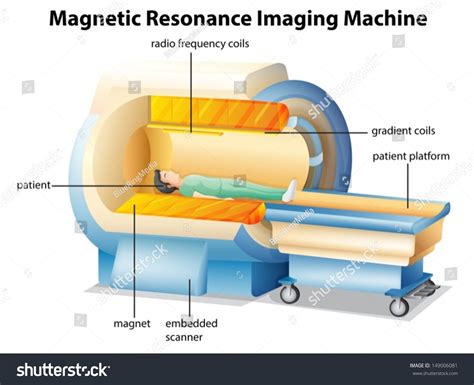 Illustration Showing Magnetic Resonance Imaging Machine 库存矢量图（免版税