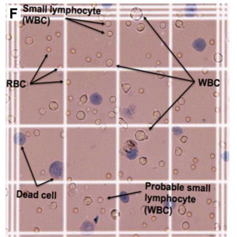 Hemocytometer Wbc