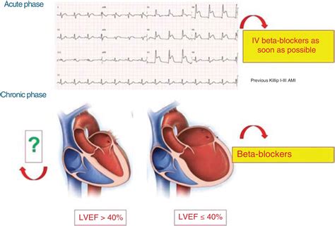 Role Of Beta Blockers In Cardiovascular Disease In 2019 Revista Española De Cardiología