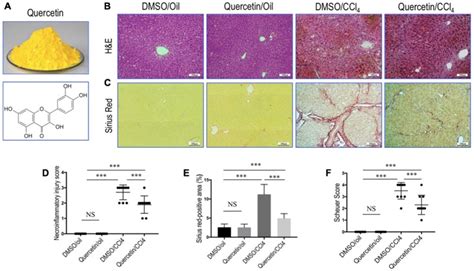 The Flavonoid Quercetin Ameliorates Liver Inflammation And Fibrosis By