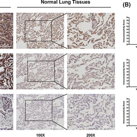 Single‐cell Transcriptomic Atlas Of 29 Samples From Normal Lung Early