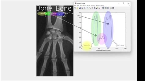 Matlab Thresholding Image Segmentation Edge Detection Image Processing Youtube