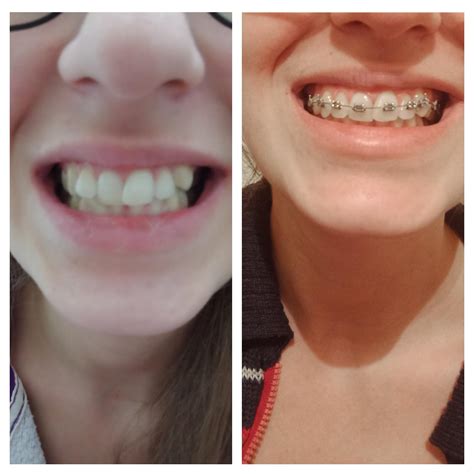 25 Months In I Didnt Believe I Would See Progress This Soon Even