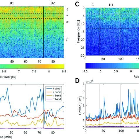 Representative Spectrogram And Band Power Graphs Spectrogram A B Download Scientific