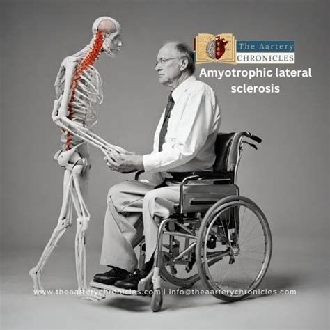 Amyotrophic Lateral Sclerosis Als All That You Need To Know