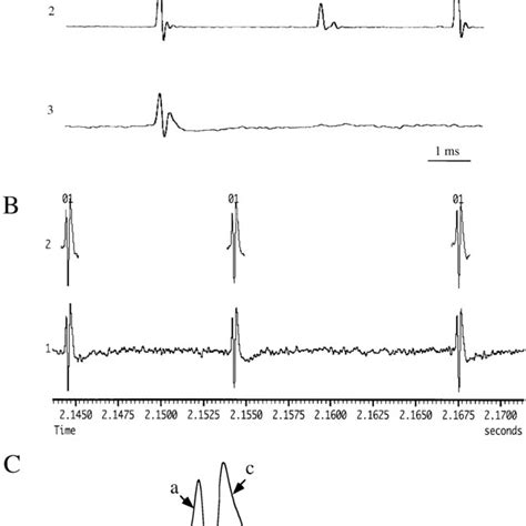 Waveform Classification And Incidence Of Individual Waveform Types As Download Scientific