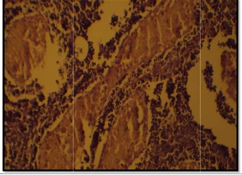 Rabbit Testis Histopathology After Two Months Of X Vacuolated Of The Rabbit Testis Histopathology After Two Months Of X Vacuolated Of The