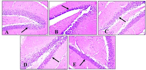 Histopathology Of Mice Brain Subiculum In Hippocampus Sections With Download Scientific