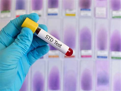 Common Std Myths Debunked The Times Of India