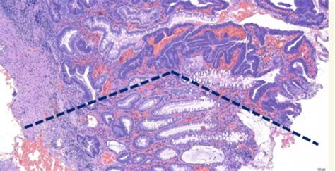 EXAM Chapter From RNA To Protein How Cells Read The Genome Part Flashcards Quizlet