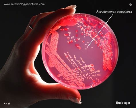 Pseudomonas Aeruginosa Embriyosu