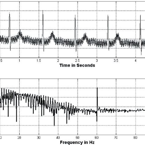 Recorded ECG Signal In Top Trace And Its Corresponding Spectrum After Download Scientific
